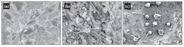 ENDOCEM MTA: Next Generation MTA Material