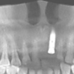 Should I Redo this Case?