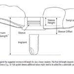 Zimmer Implants: Drilling Protocol for Guided Surgery?